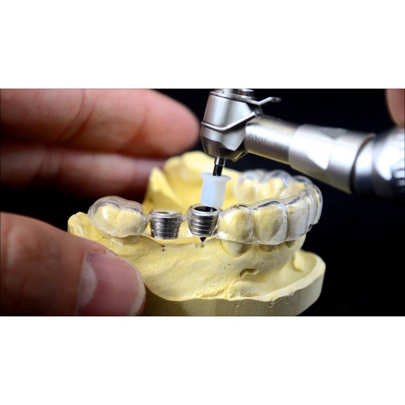 3D Gadgets Malaysia | Magma Surgical Guide Resin